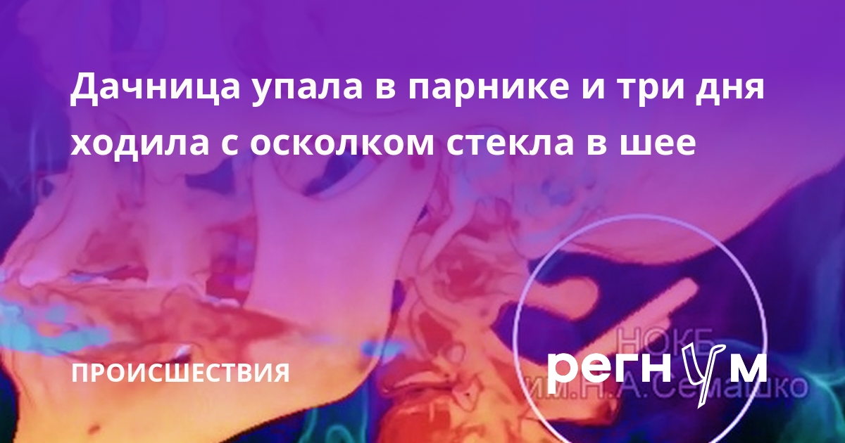 Дачница упала в парнике и три дня ходила с осколком стекла в шее - ИА ...